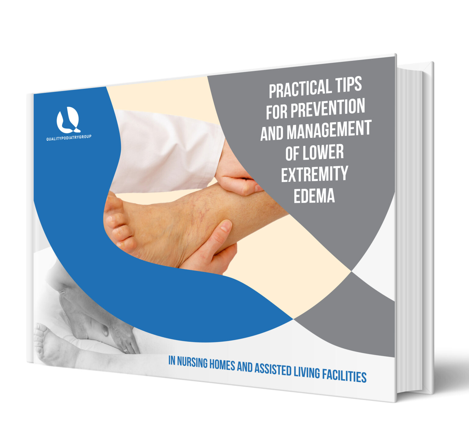 Practical Tips for Prevention and Management of Lower Extremity Edema ...